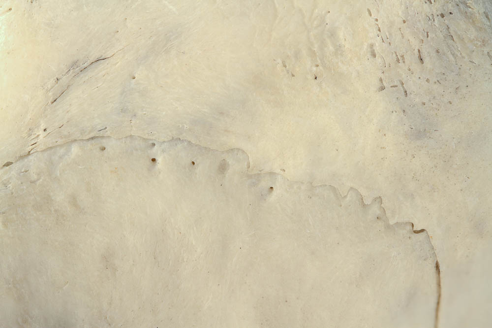 This is bone | Susan Michie